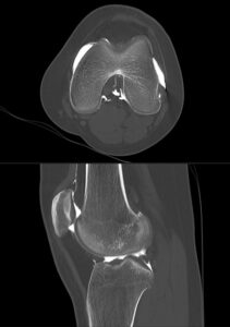 Scanner - Imagerie Médicale de la Fondation du Diaconat