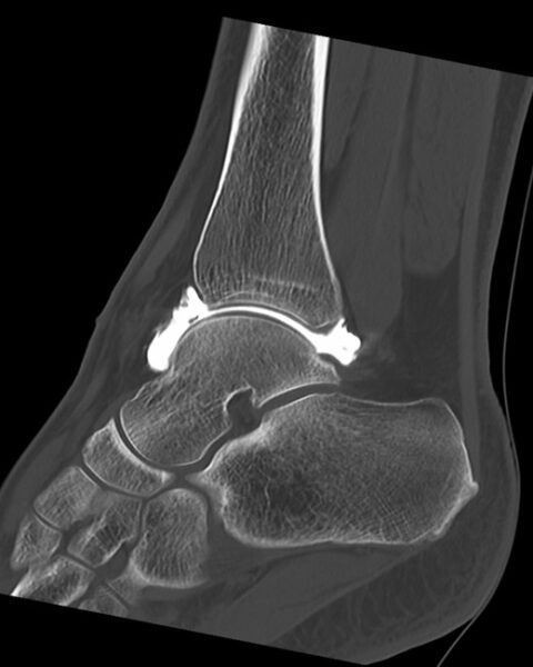 Scanner - Imagerie Médicale de la Fondation du Diaconat