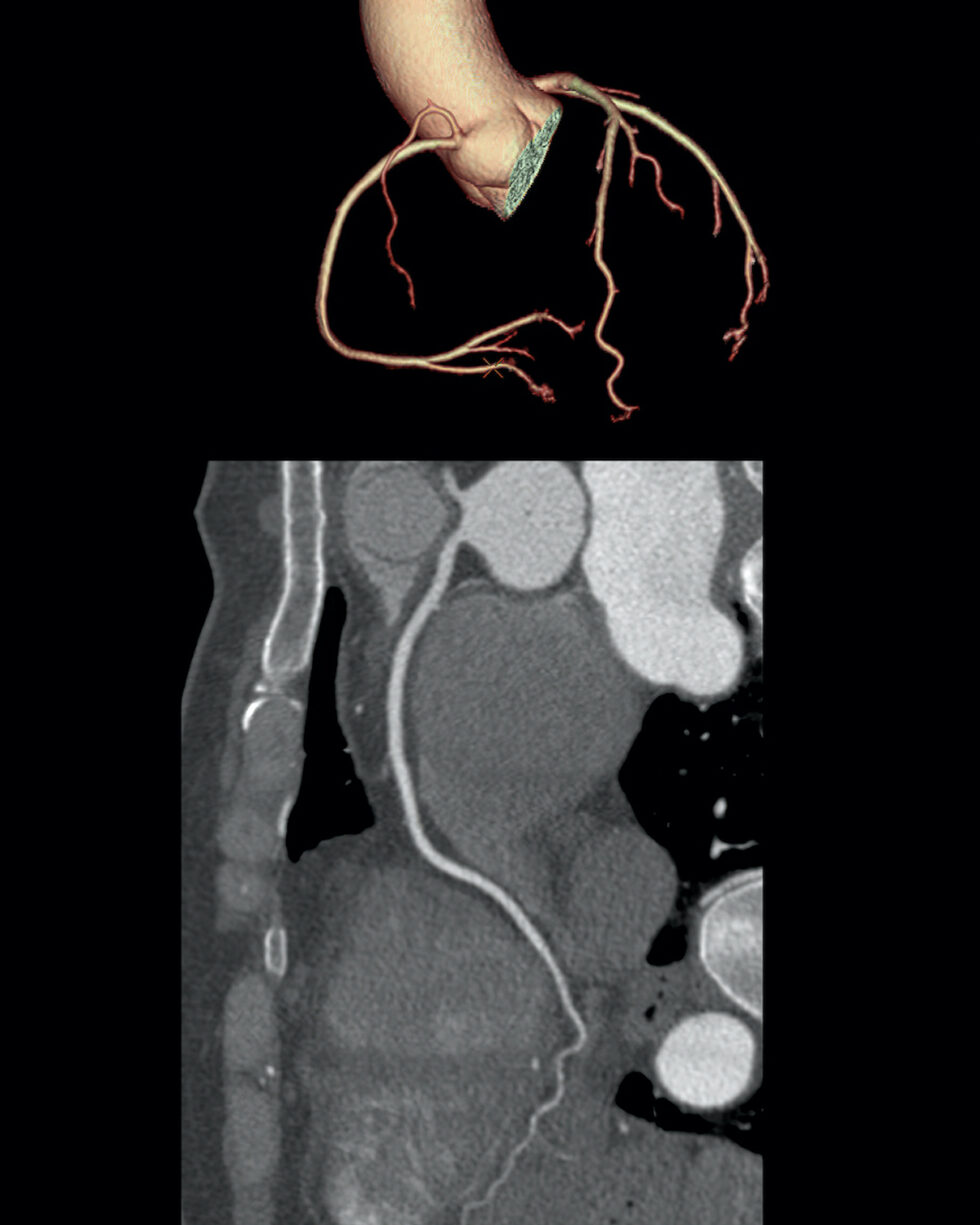 Scanner - Imagerie Médicale de la Fondation du Diaconat