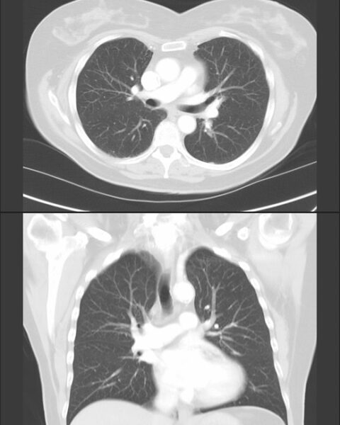 Scanner - Imagerie Médicale de la Fondation du Diaconat