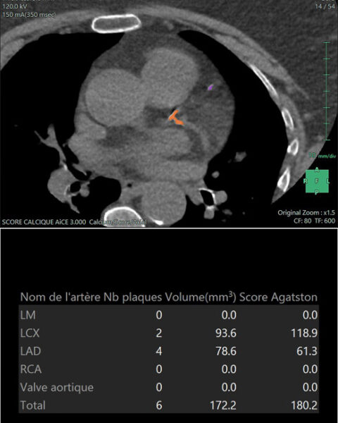 Scanner - Imagerie Médicale de la Fondation du Diaconat